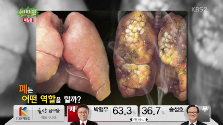 폐 건강 만성 폐쇄성 페질환 폐결핵 폐암 네이버 블로그
