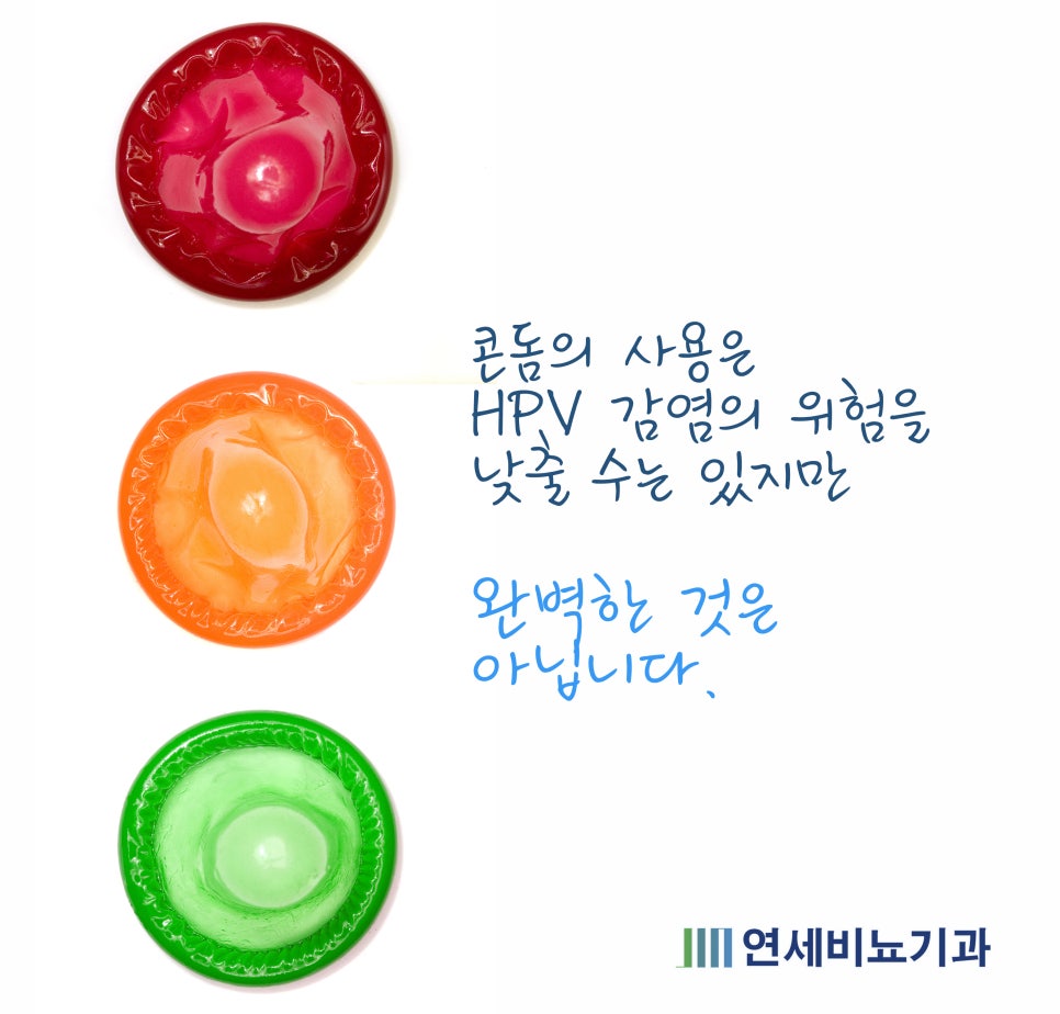 Hpv인유두종바이러스와 콘딜로마곤지름 생식기사마귀에 대해 알아봅시다 네이버 블로그