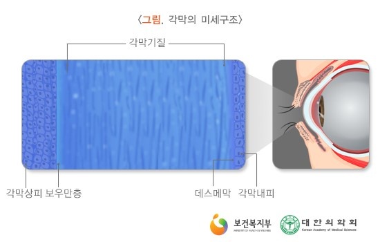 각막내피세포란 네이버 블로그