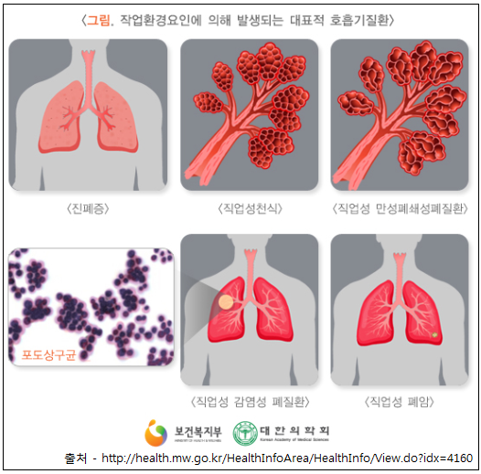 만성폐쇄성폐질환copd 산재처리 기준 네이버 블로그