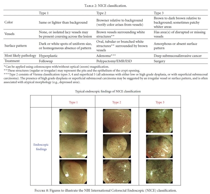 Narrow band imaging (NBI) magnifying classification for colon tumors ...