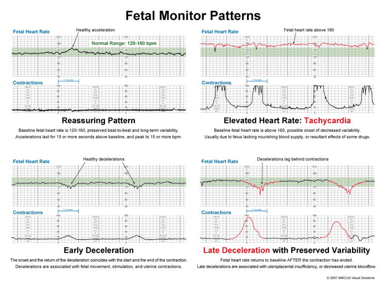 [임신36주4일] 자궁수축으로 분만실 내원- 태아안녕검사(NST)와 초음파검사 : 네이버 블로그
